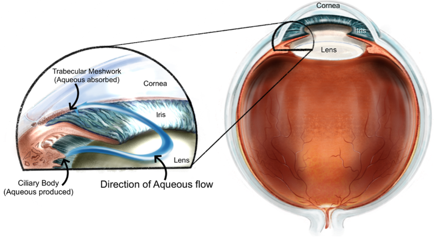 Selective laser trabeculoplasty - Moorfields Eye Hospital